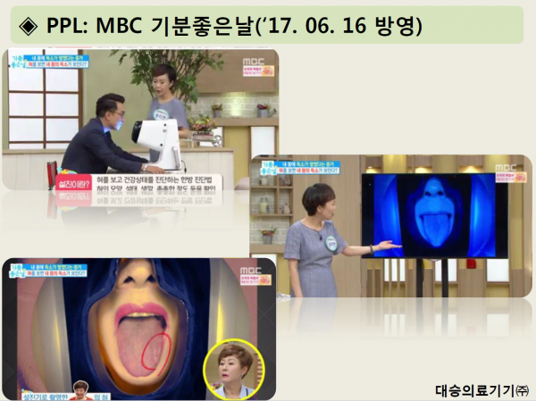 [CST-1000] (2017.06.16) MBC 기분좋은날 설진기 PPL > 보도자료 | 대승의료기기